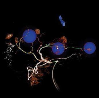 ARTIS pheno Angiography System