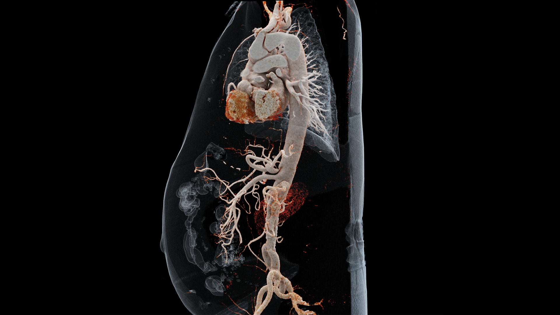 NAEOTOM Alpha Photon Counting CT System