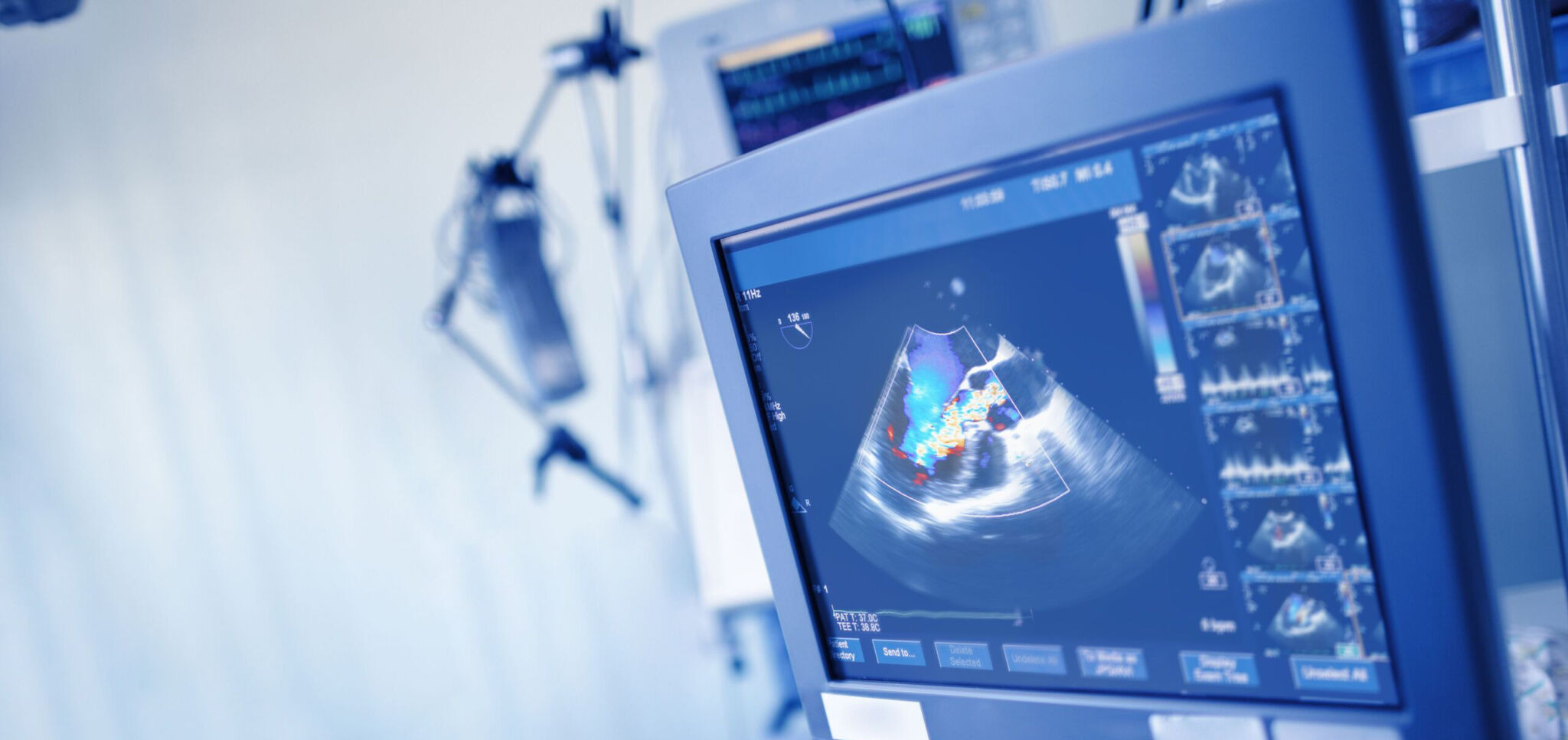 Cassling Partner Echo IQ Secures FDA Clearance for EchoSolv AS