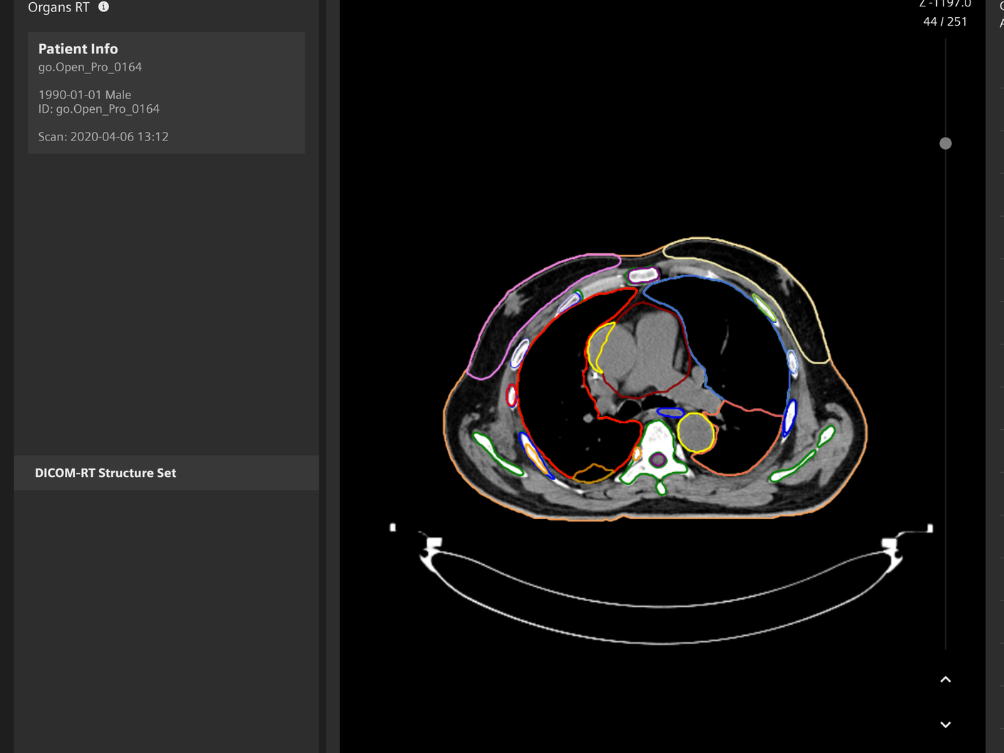 AI-Rad Companion Organs RT Intelligent Software Assistant Cleared By FDA